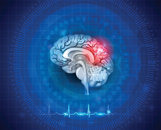 Post Concussion Syndrome And Treatment post-concussion-syndrome-and-treatment